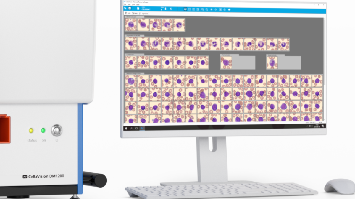 Cellavision - Dagens PS