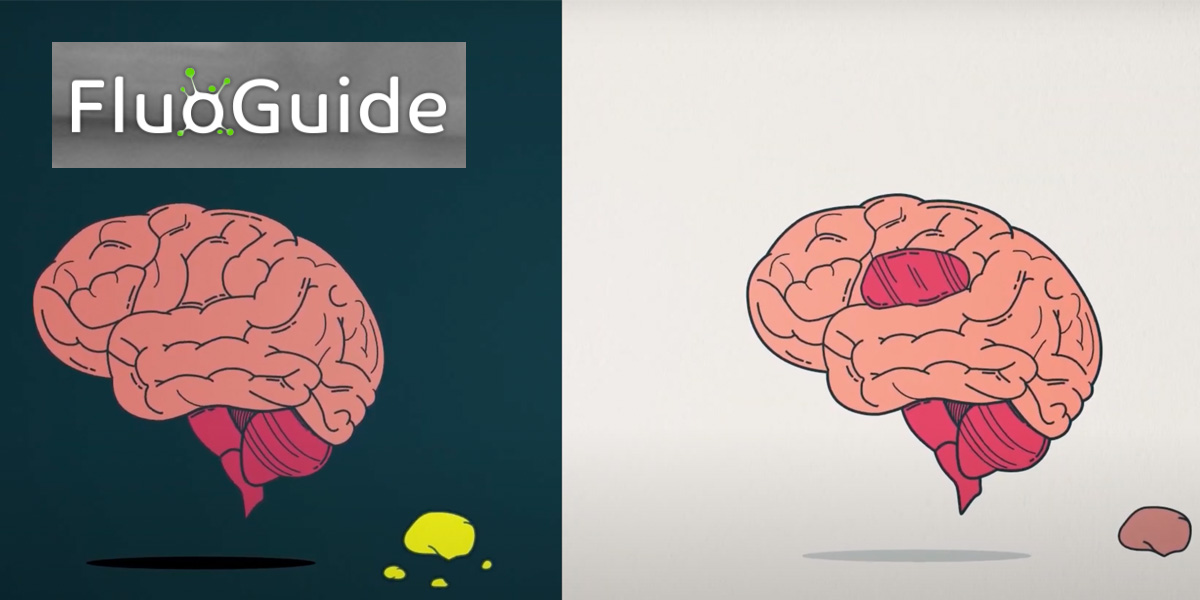 FluoGuide - Dagens PS